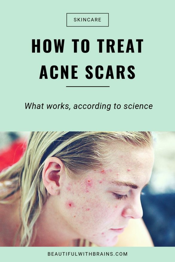 How To Treat Acne Scars: The Complete Guide – Beautiful With Brains